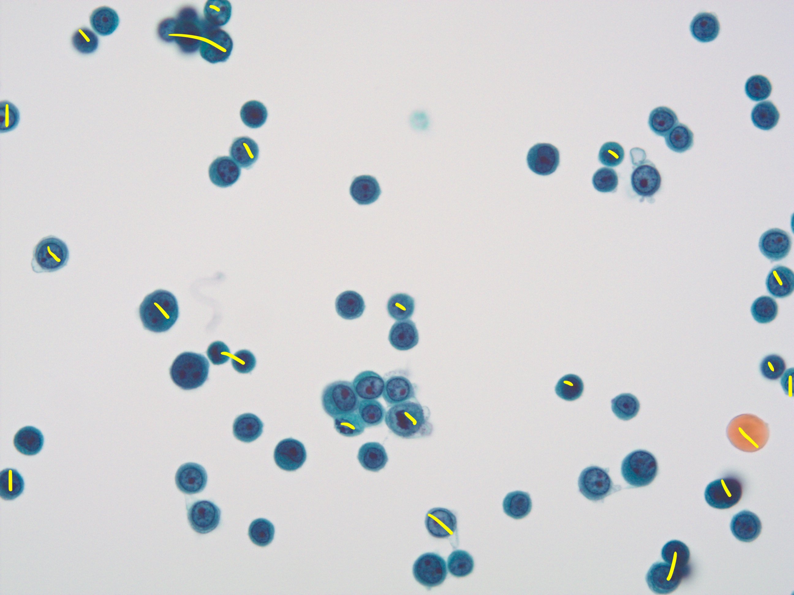 AC Instance Segmentation Dataset by Cell morphological changes and object detection