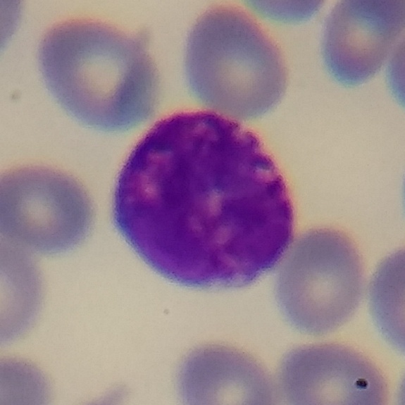 wbc_v1 Classification Dataset by whitebloodcell