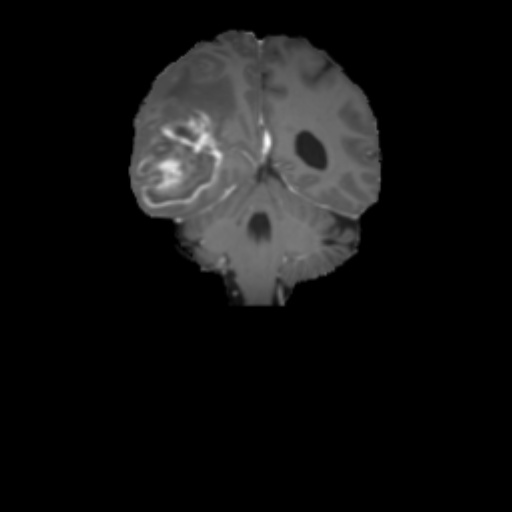 Brain Object Detection Dataset By Mansoor Alam