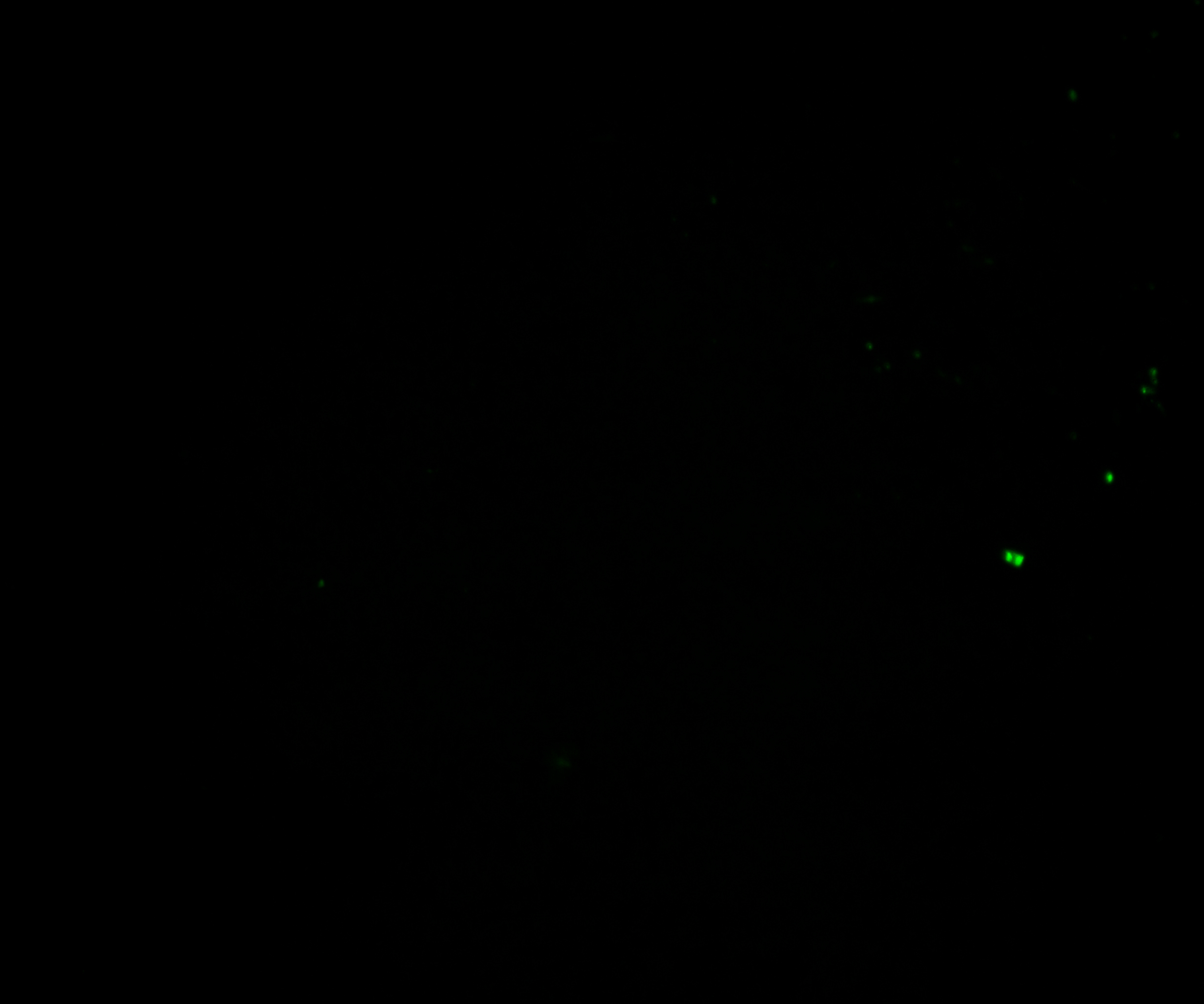 Microclot Classification Dataset and Pre-Trained Model by Micro