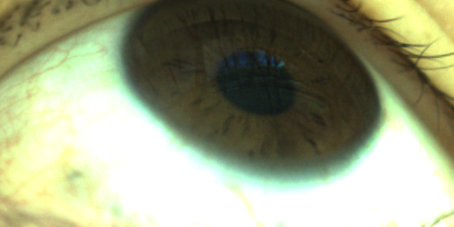 Irissegmentation Semantic Segmentation Dataset And Pre Trained Model By Iris Segmentation