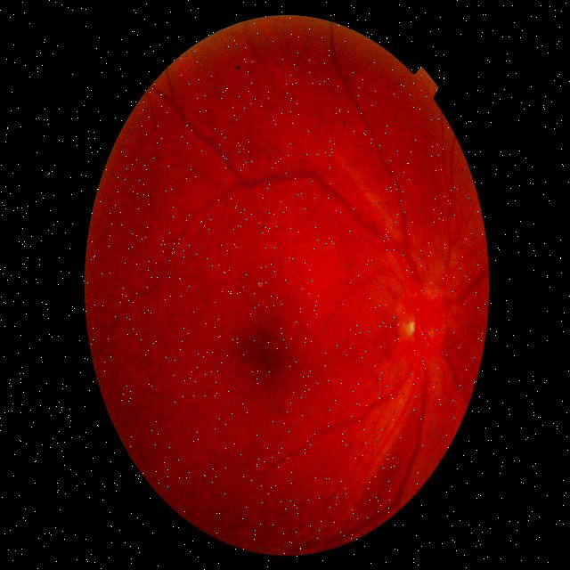 DDR-Set Object Detection Dataset by dip