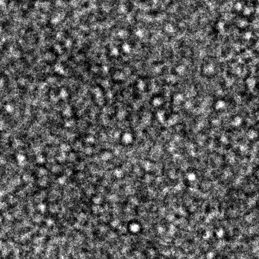 Cavity Object Detection Dataset by TAMU ECE