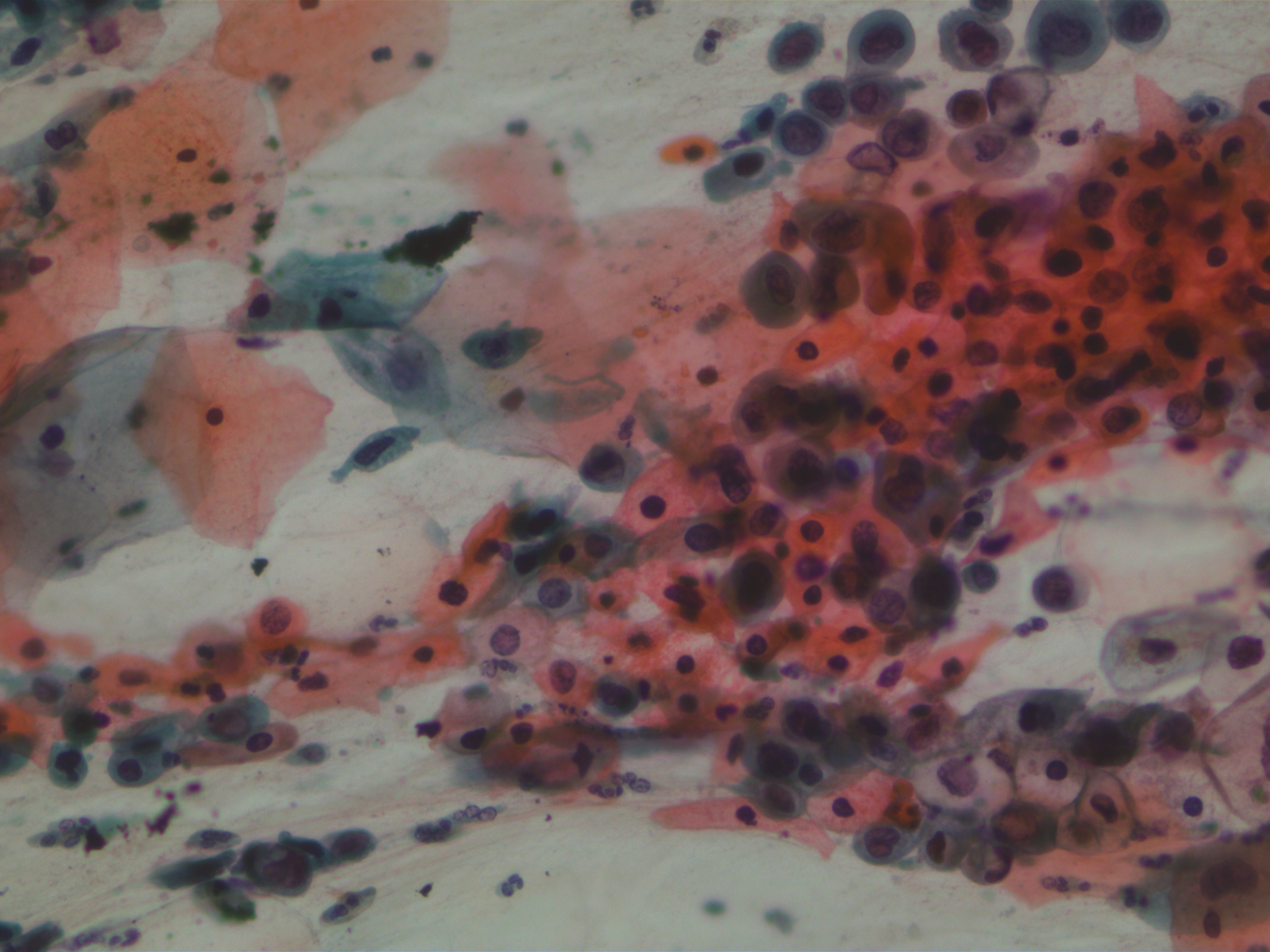 Cervical_cancer_detection Classification Dataset by Projects