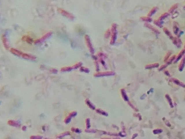 E.coli Detection Object Detection Dataset and Pre-Trained Model by ...