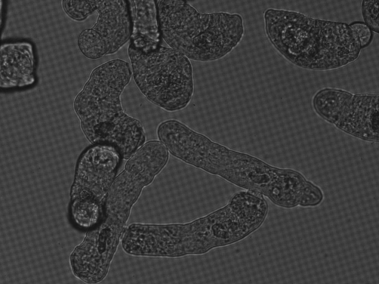 worm Object Detection Dataset and Pre-Trained Model by class