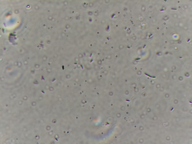 Ecoli Object Detection Computer Vision Dataset By Ens Parissaclay