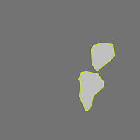 Late Blight detection Instance Segmentation Dataset and Pre-Trained Model by Biotech Project