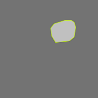 Late Blight detection Instance Segmentation Dataset and Pre-Trained Model by Biotech Project