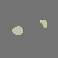 Late Blight detection Instance Segmentation Dataset and Pre-Trained Model by Biotech Project