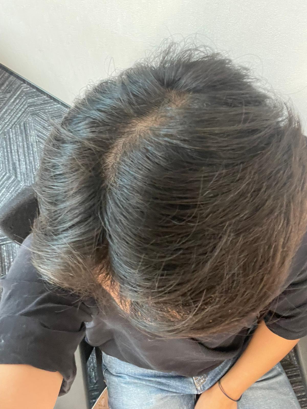 Top-of-Head-Detection Object Detection Dataset and Pre-Trained Model by HairCoSys