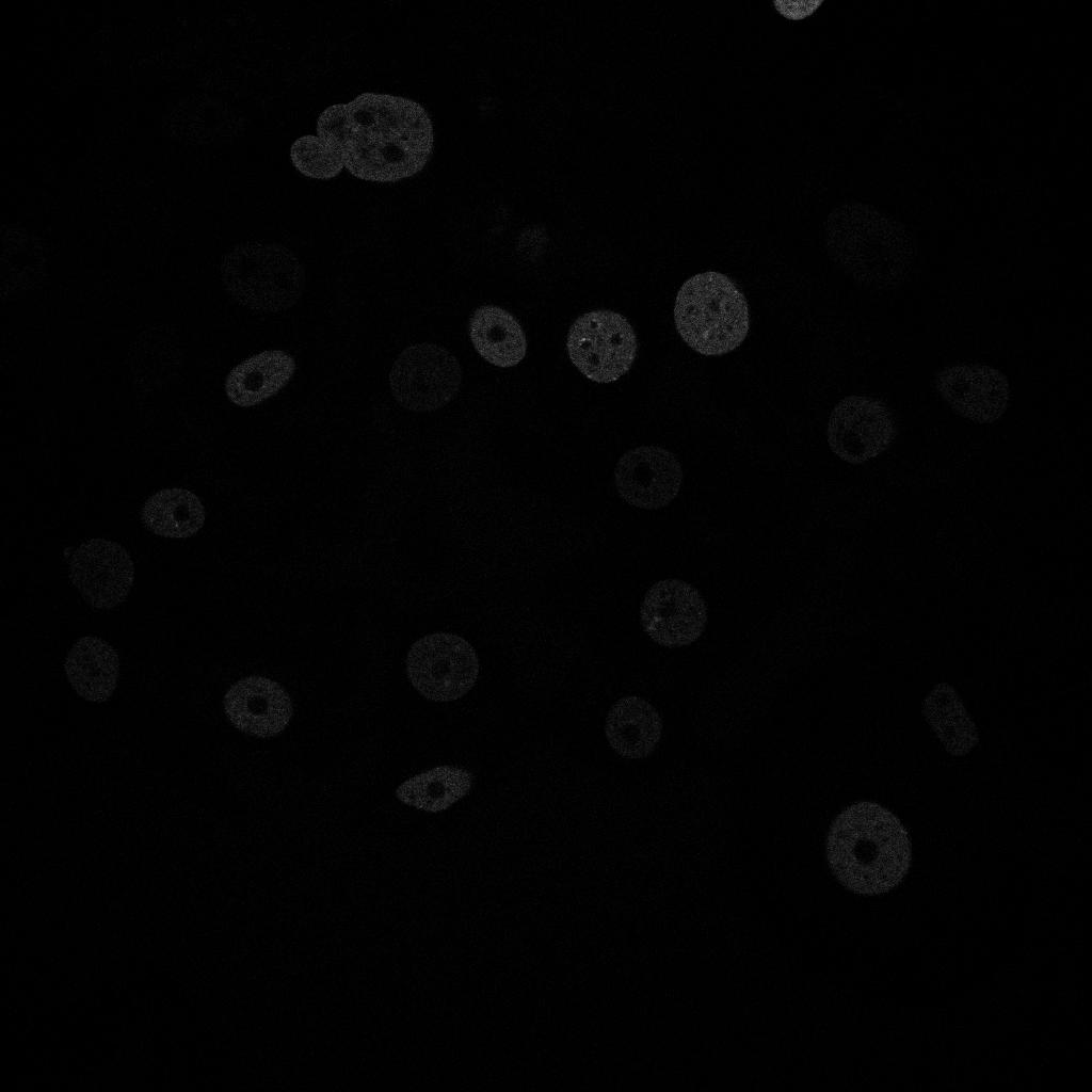 mouse stem cells Object Detection Dataset and Pre-Trained Model by ...