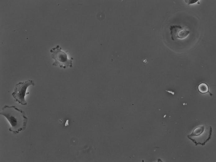 cell detector Object Detection Dataset and Pre-Trained Model by ...