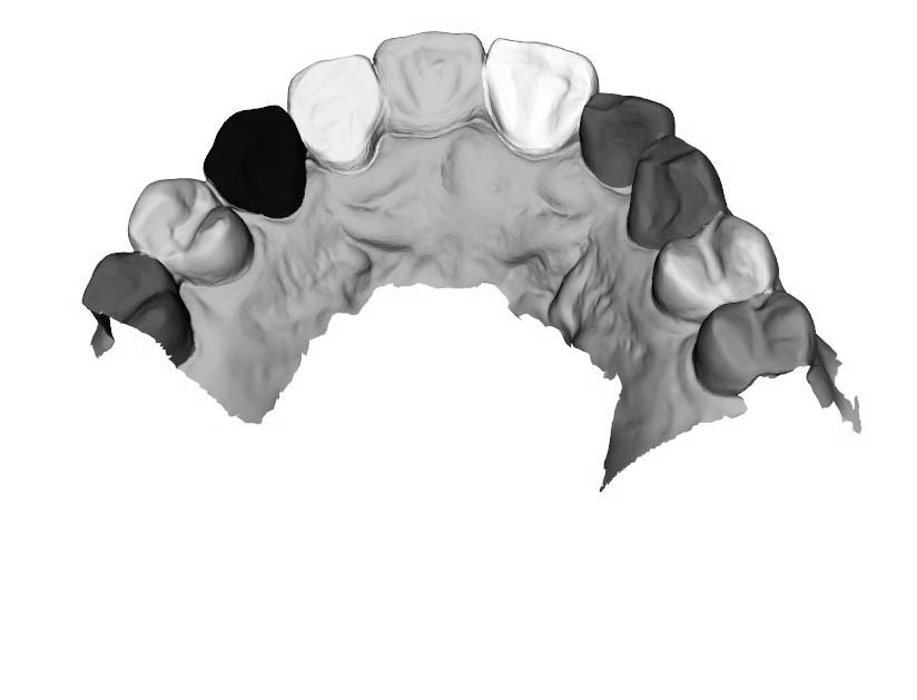 teeth Instance Segmentation Dataset by kyungpook national university