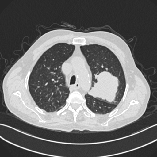 How to Use the lug detection Object Detection API