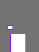 Glove defect detection Object Detection Dataset and Pre-Trained Model by aliar2456@gmail.com