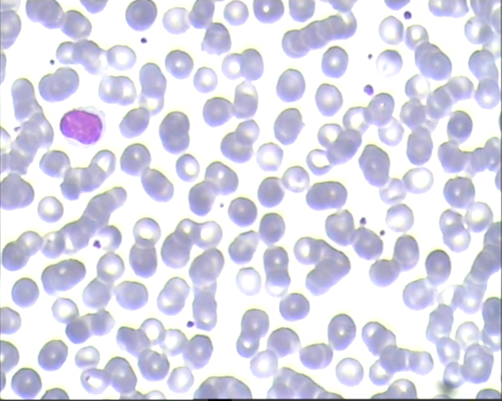 Blood Cell New Microscope Object Detection Dataset (v1, 2023-03-01 10 ...