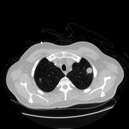 Nodule classification Classification Dataset by ss
