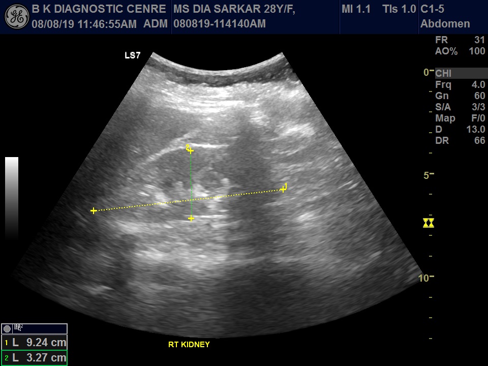 Organs Detector Object Detection Dataset and Pre-Trained Model by Pcare ...