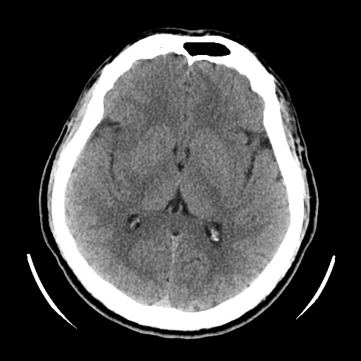 brain Instance Segmentation Dataset by project-c8hdj