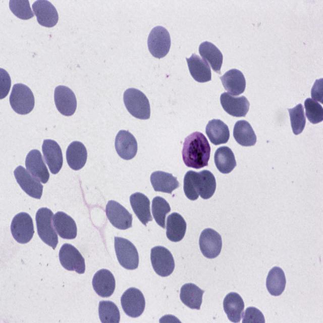 Malaria Detection Object Detection Dataset By Malaria 7456