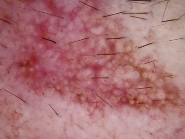 Skin Detection Dataset And Pre Trained Model By Class