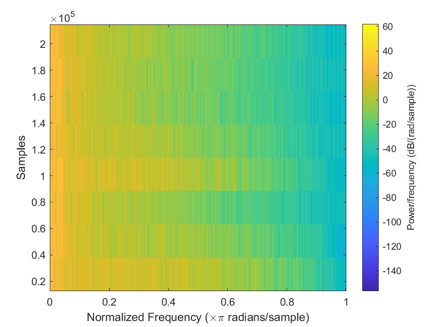 EEG_depression Classification Dataset and Pre-Trained Model by Atoosa