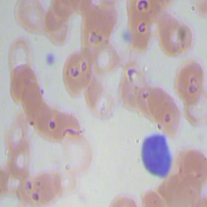 Blood Cell Test Object Detection Dataset by Tony Workspace