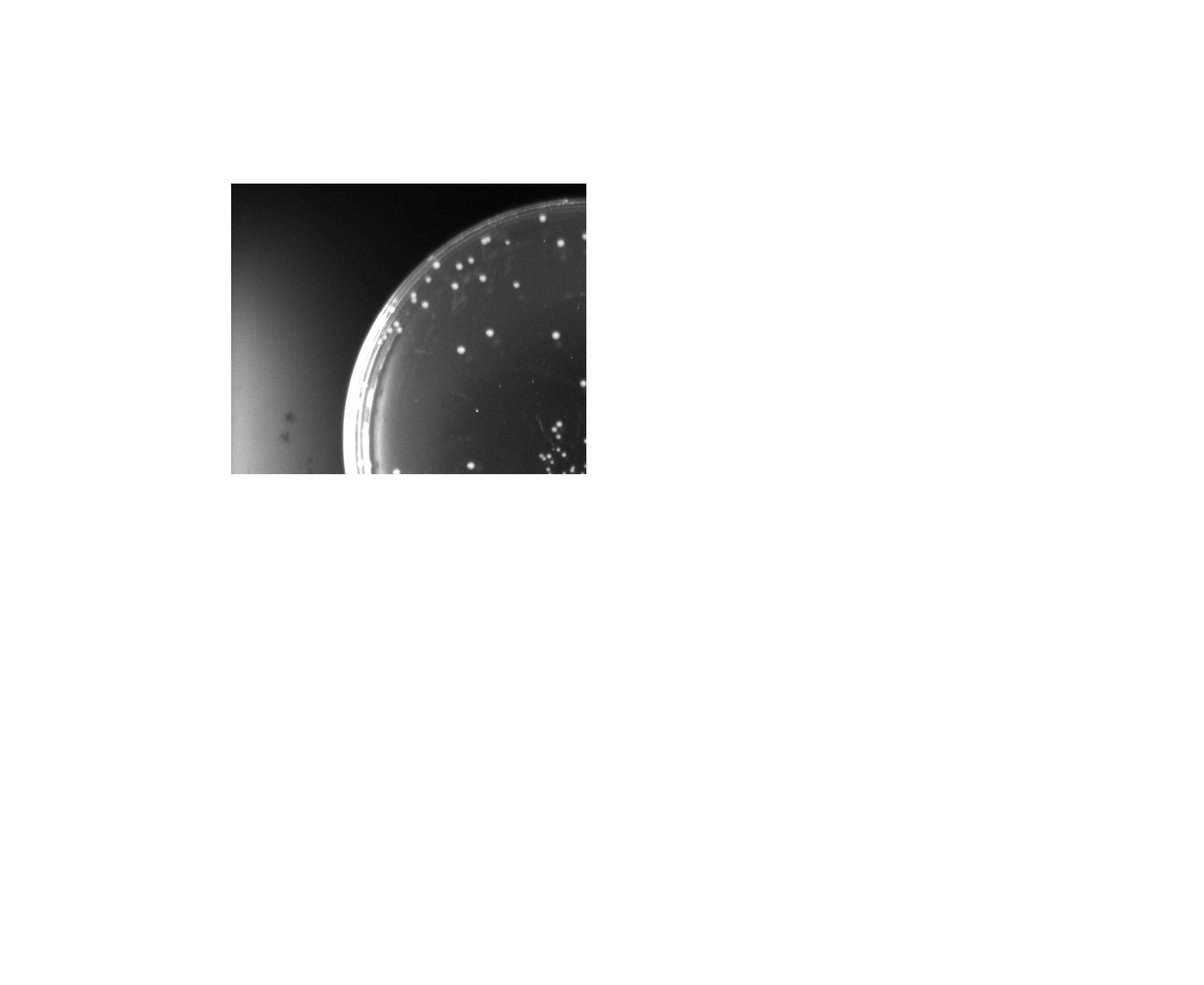 bacteria Object Detection Dataset by yhh