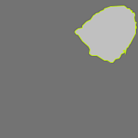 beetles-abdomen Instance Segmentation Dataset by Mealworms