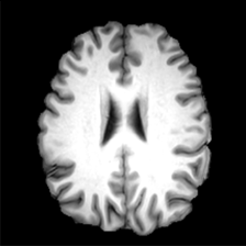 MRI Depression Classification Dataset and Pre-Trained Model by school