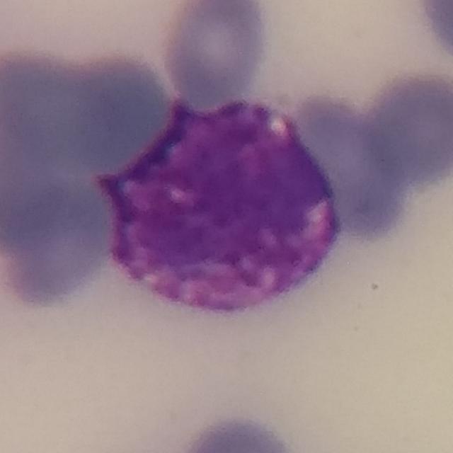 blood-cell-detection Object Detection Dataset and Pre-Trained Model by NIR