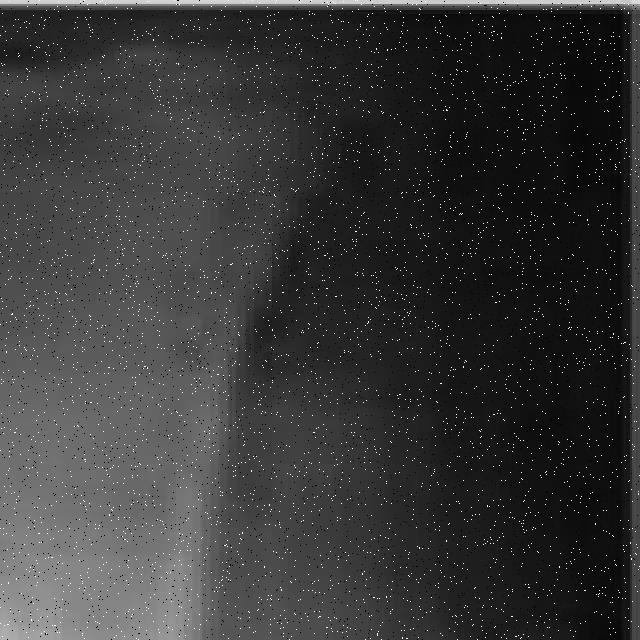 Bone Fracture Object Detection Dataset By Unit