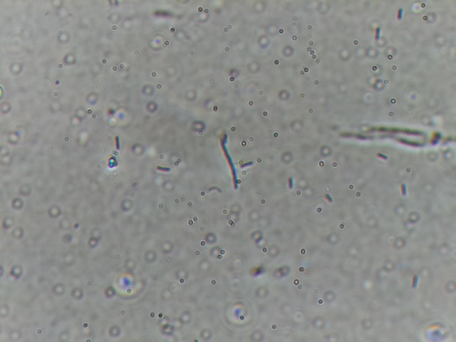 Ecoli Detection Object Detection Dataset And Pre Trained Model By Test