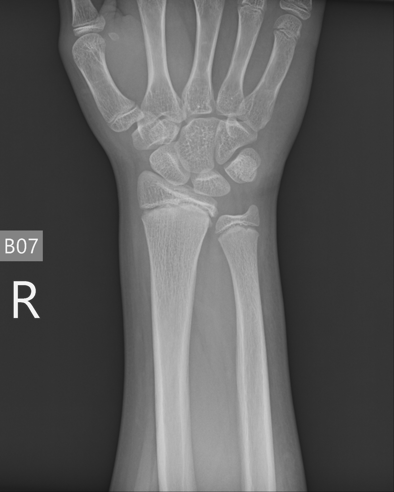 How to Use the Detection fractions Object Detection API