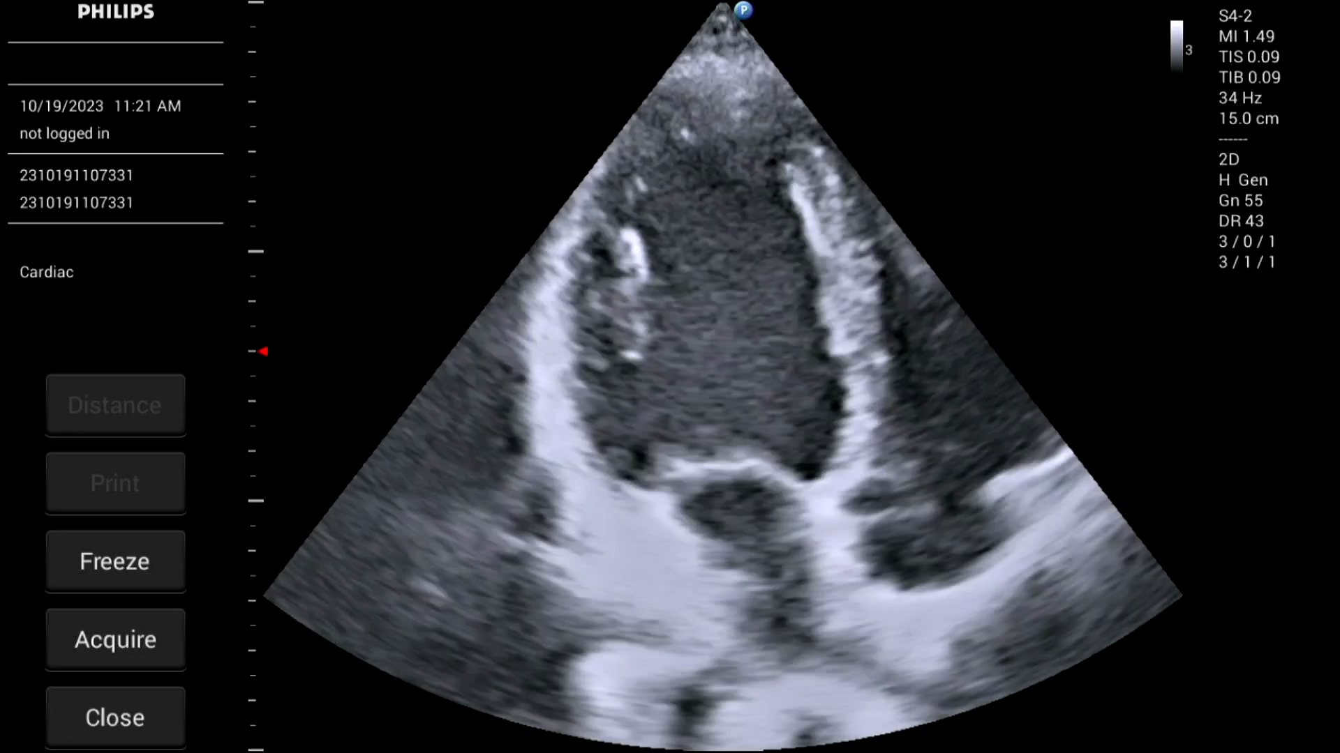 echo Instance Segmentation Dataset by kuda