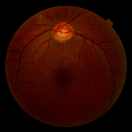 Od Detection V2 Object Detection Dataset By Public