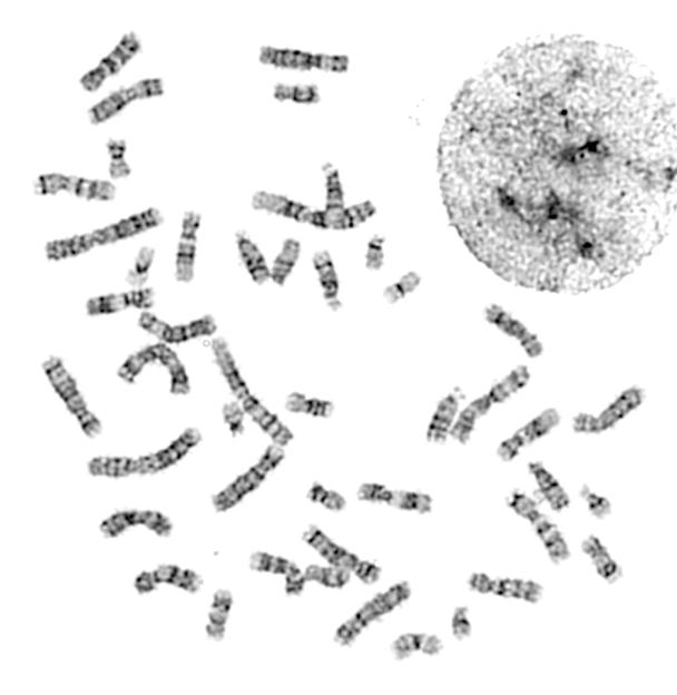 Chromosome Detection2 Bounding Box Object Detection Dataset V1 2023