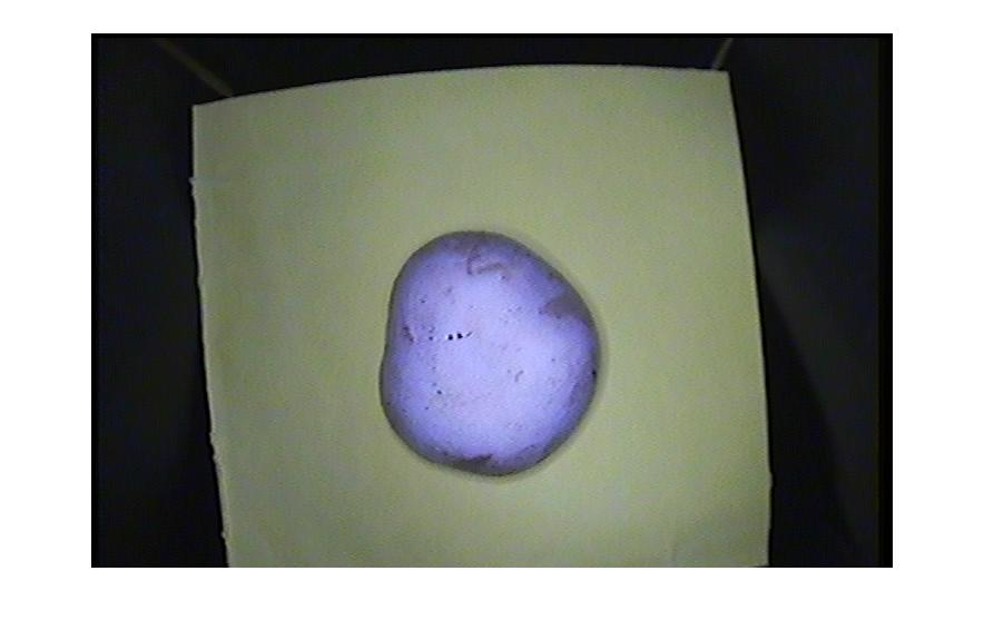 Ultrasound Object Detection Dataset V1 2023 07 21 12 07pm By Object