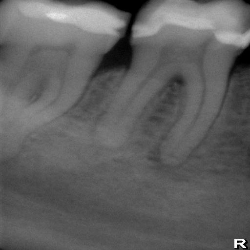 tn2 - Roboflow Universe