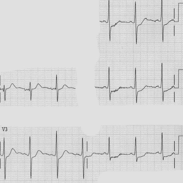ecg_labeled_Marzo Object Detection Dataset and Pre-Trained Model by centro oncolgico integral