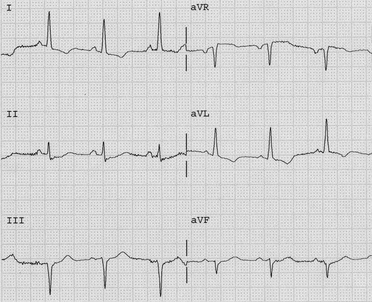 PORFAVORR_ecg Object Detection Dataset and Pre-Trained Model by centro oncolgico integral