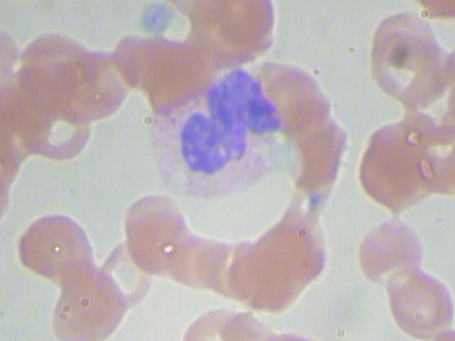 Blood Cell Detection Object Detection Dataset and Pre-Trained Model by ...