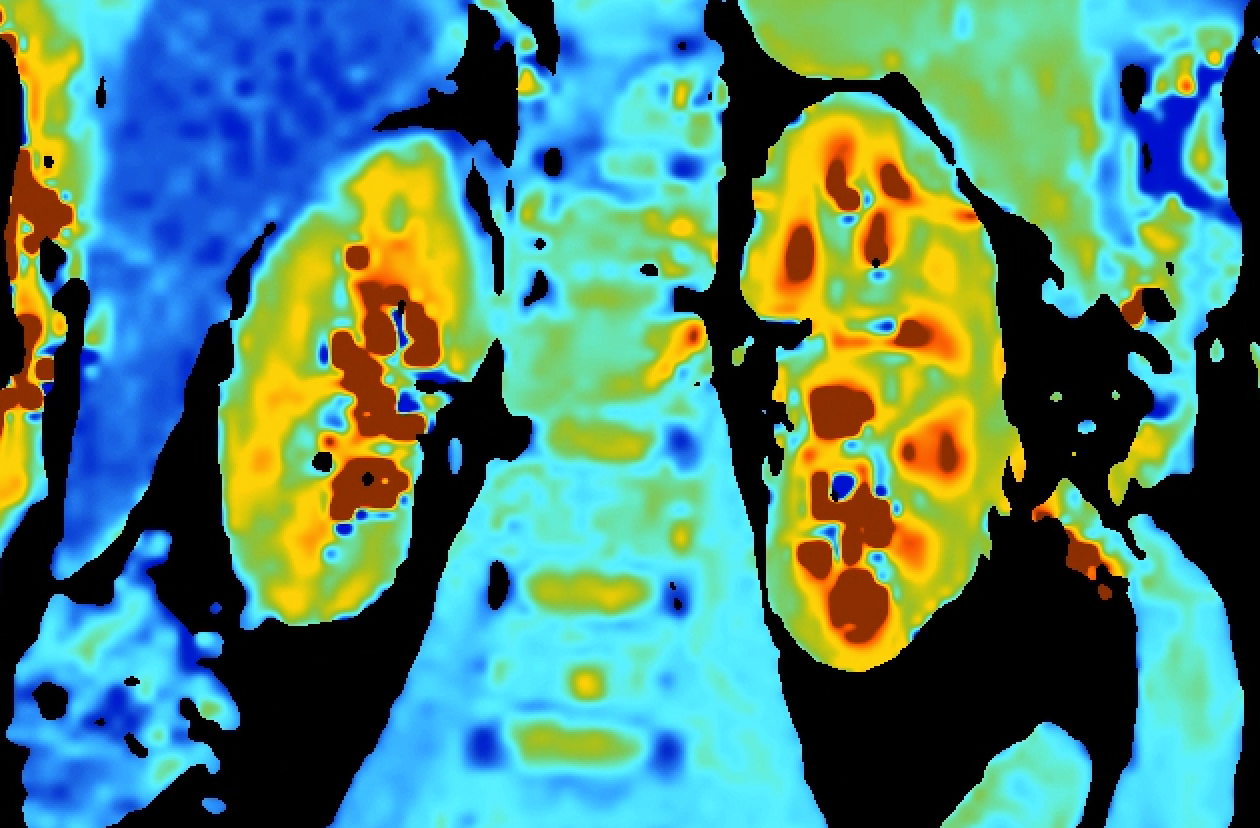 Megaalborg (megaalborg-samlu) - Roboflow Universe