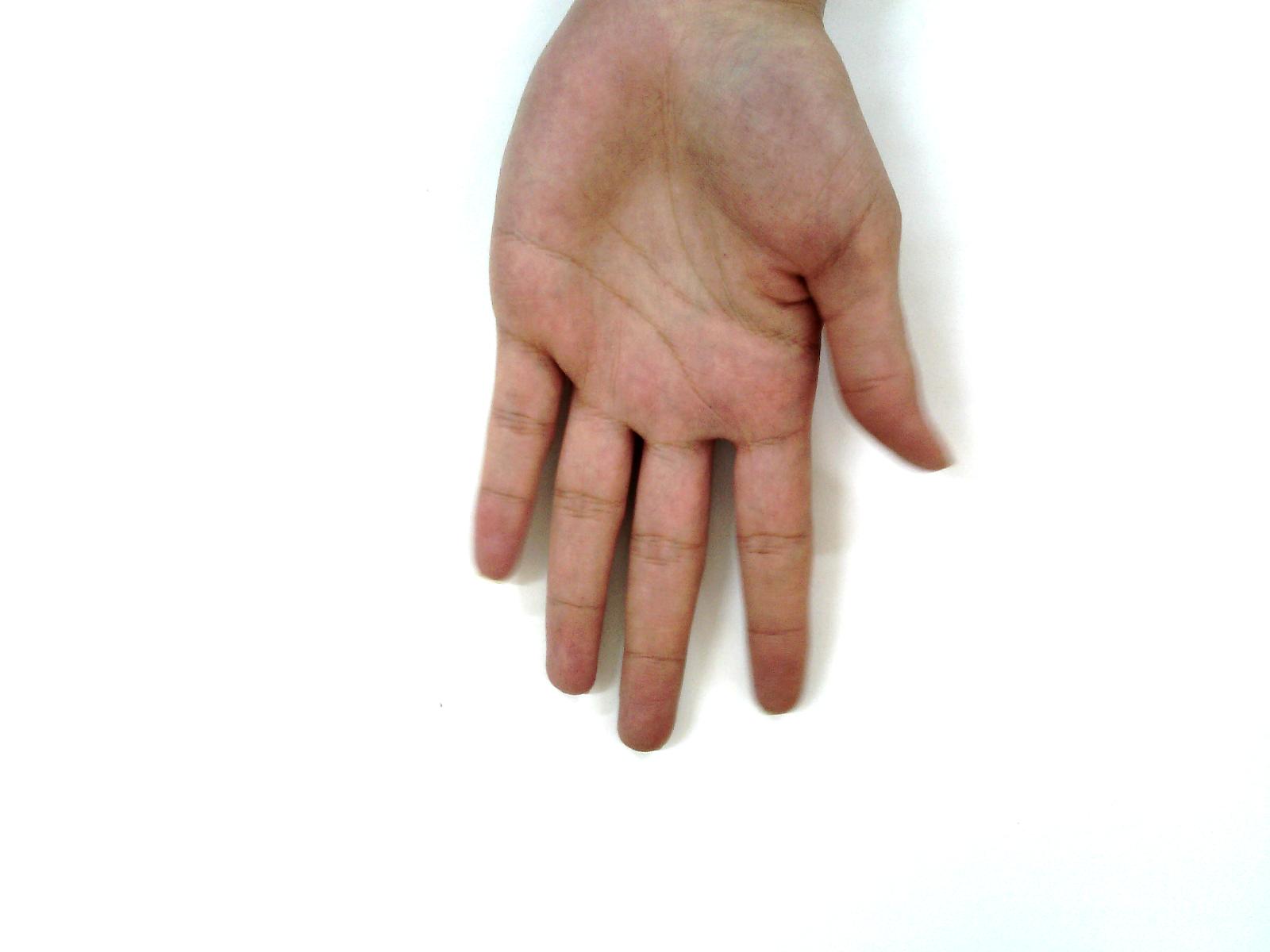 How to Use the palm Object Detection API