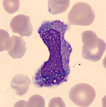 How to Use the Blood cell counting Instance Segmentation API
