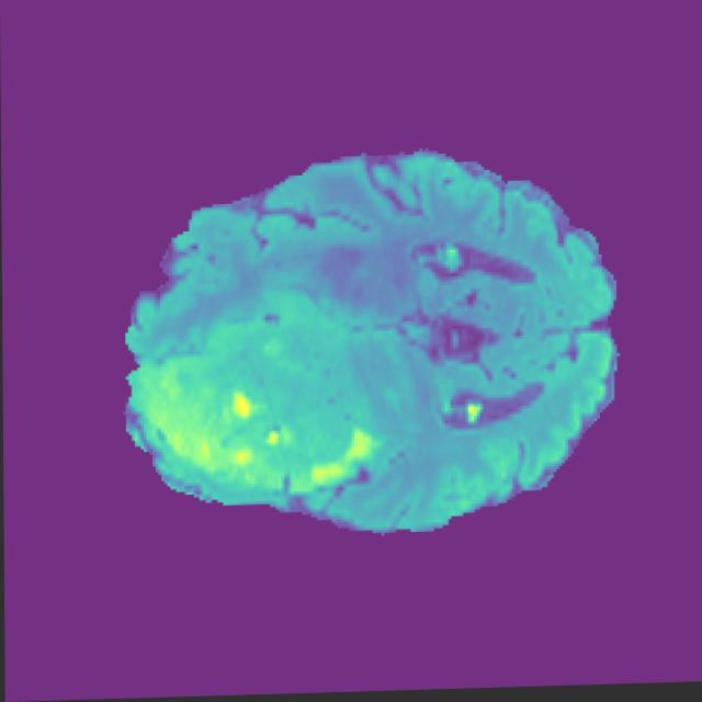 tum Object Detection Dataset by hassen mh