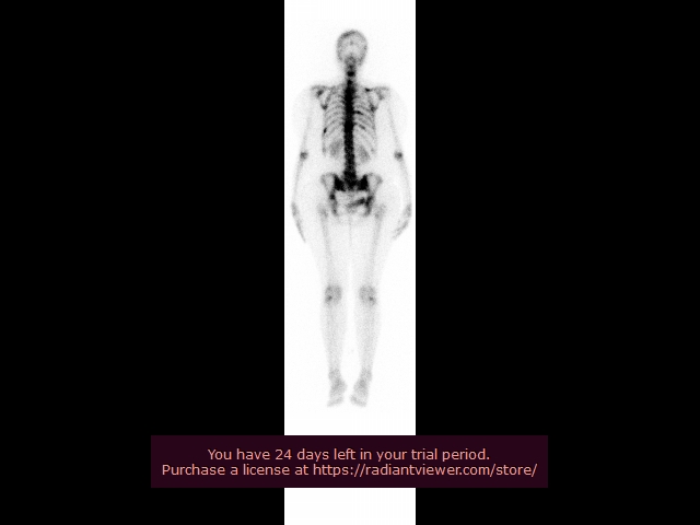 Zee Object Detection Dataset By Zeeshan Hameed