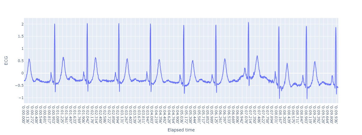 Frequncy_Ecg Object Detection Dataset by LJIET