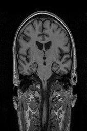 Age classification Object Detection Dataset by AIMLWictronix
